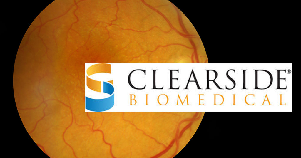 OIS - Ophthalmology Innovation Summit