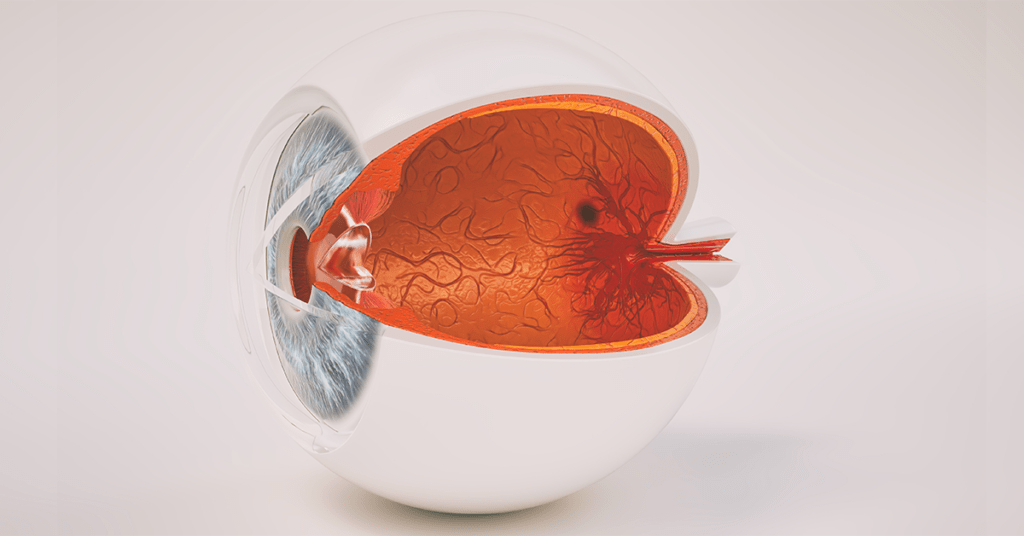 Retina Is Where the Research Is, and Other Big Players Want In ...